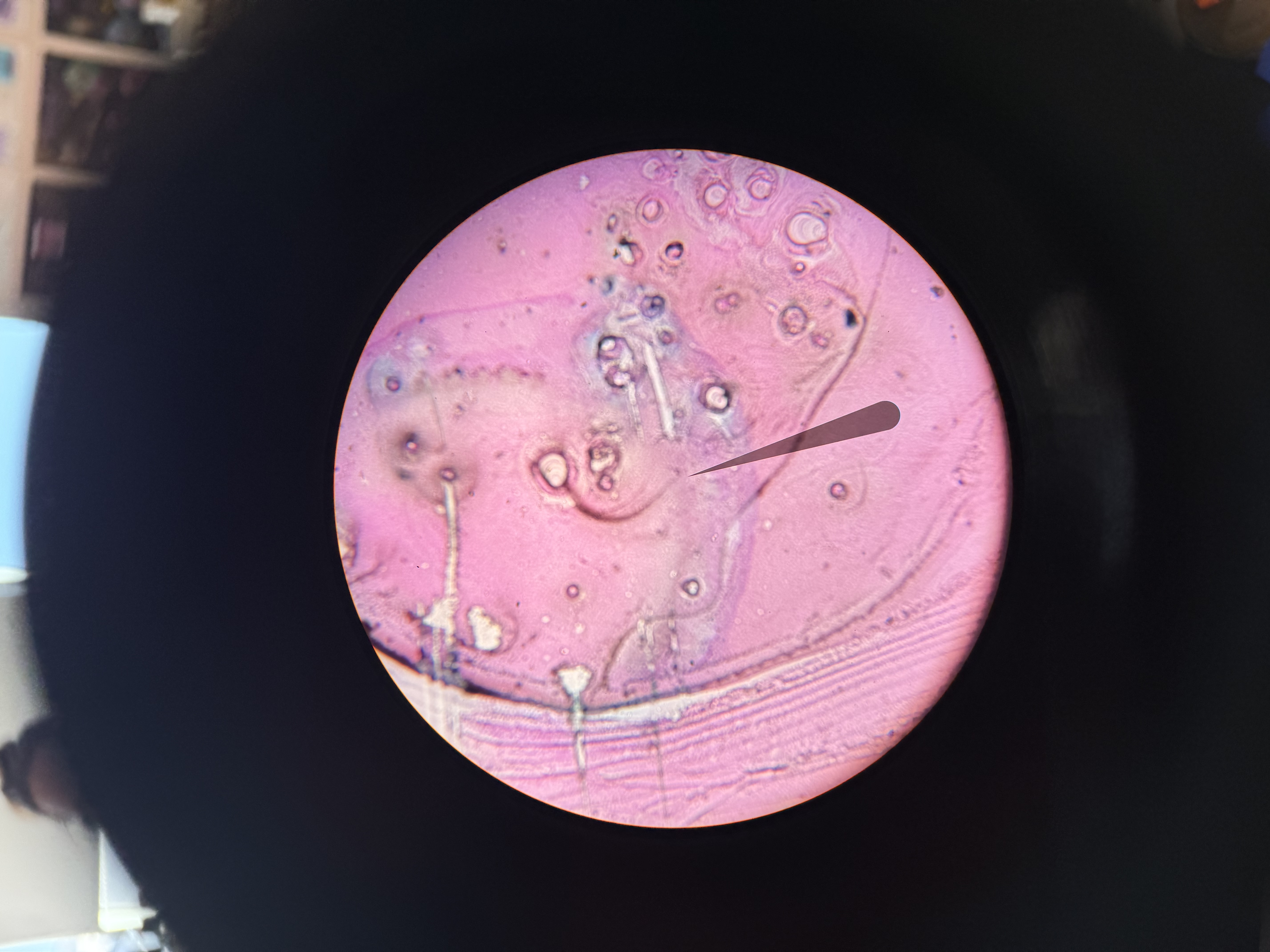 Solved What bacteria species is this and is it capsulated | Chegg.com Solved What bacteria species is this and is it capsulated | Chegg.com
