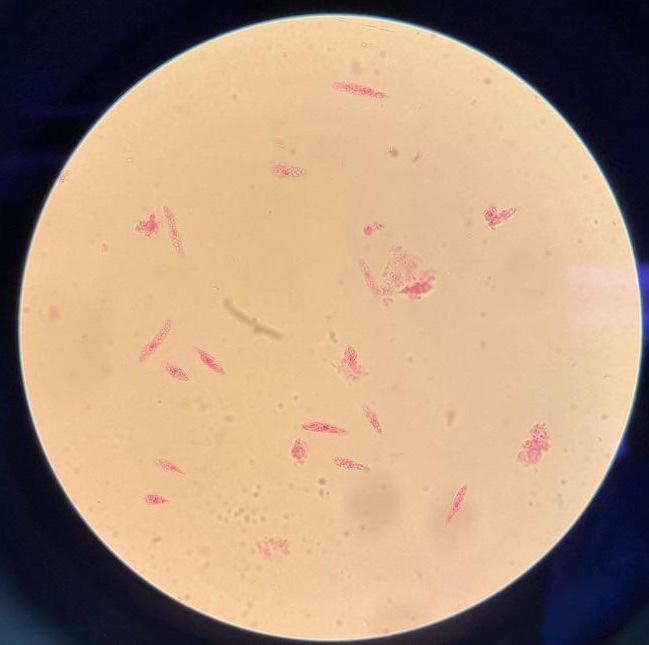 Solved Euglena The Flagellum Appears To Be Inserted Into A