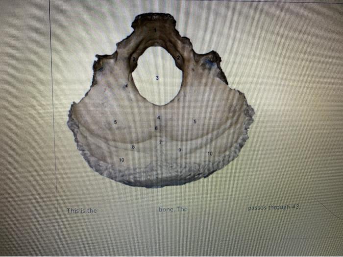 Solved Name the bone 8 10 This is the bono, The passes | Chegg.com