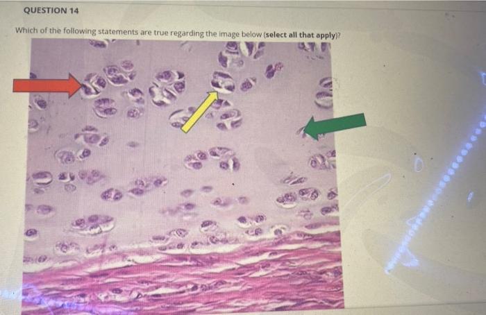 Solved Which of the following statements are true regarding | Chegg.com