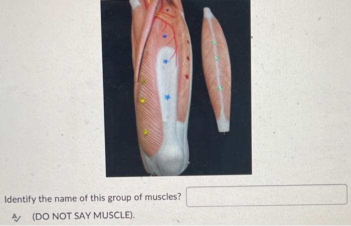 Solved Identify the bony landmark deepest part of the bowl). | Chegg.com