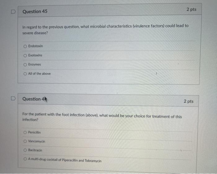 Solved 2 pts D Question 45 In regard to the previous | Chegg.com Solved 2 pts D Question 45 In regard to the previous | Chegg.com