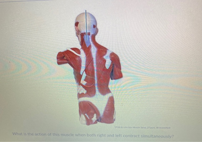 Solved TVA Muscle tone. 18 centi What is the action of this | Chegg.com