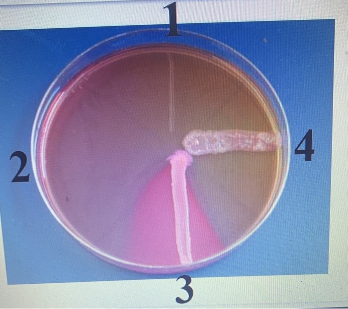 Solved inoculate 4 different cells in MAC plate, and | Chegg.com