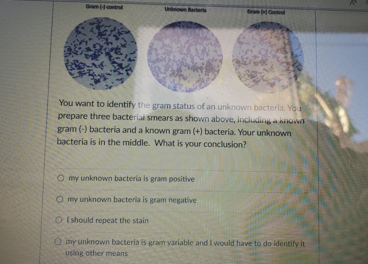 Solved Gram(-) control Unknown Bacteria Gram (1) Control You | Chegg.com
