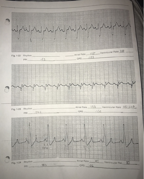 Solved whenuhhhh Ventricular Rate U. Fig. 1-22 Rhythm PRI | Chegg.com
