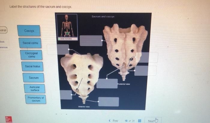 Solved Label the structures of the sacrum and coccyx Sacrum | Chegg.com
