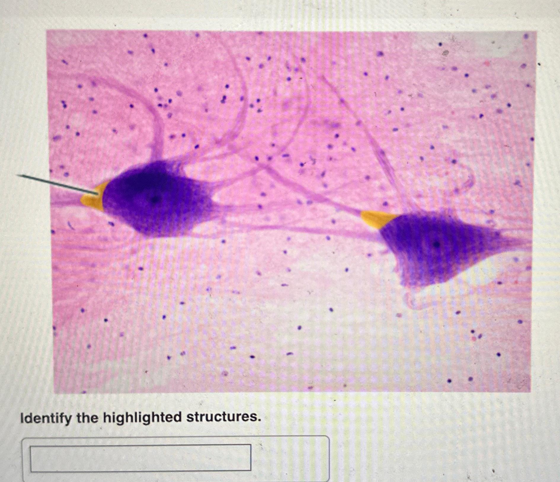Solved Identify the highlighted structures. | Chegg.com Solved Identify the highlighted structures. | Chegg.com