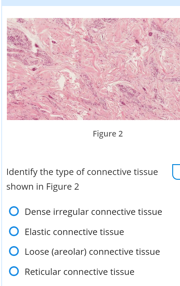 Solved Figure 1 Identify the type of connective tissue shown | Chegg.com