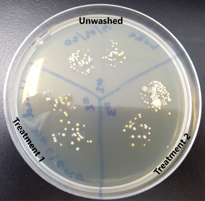 Solved Microflora of the Human Skin: Hand HygienePresent a | Chegg.com