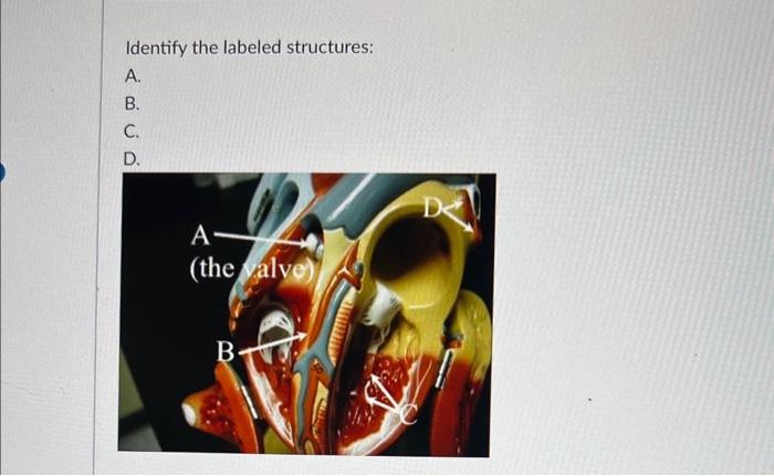 Solved Identify the labeled structures: A. B. C. D. | Chegg.com