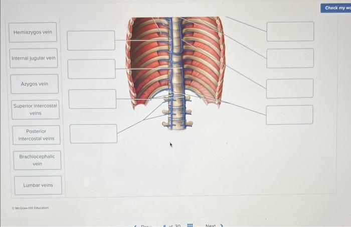 Solved identify the anterior view of the veins in the | Chegg.com