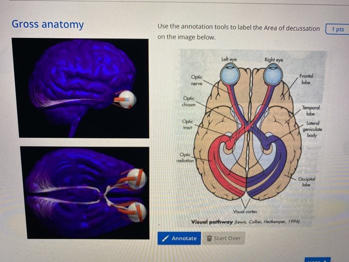 Solved Gross anatomy Use the annotation tools to label the | Chegg.com