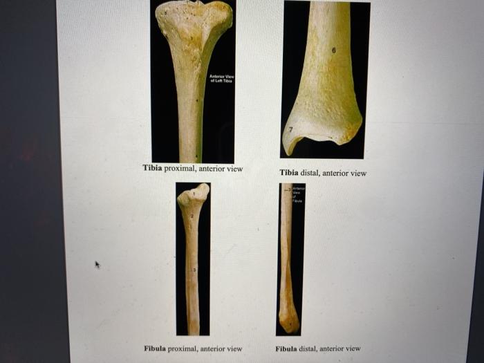 Solved Lab 10: Appendicular Skeleton - Lower Appendages | Chegg.com