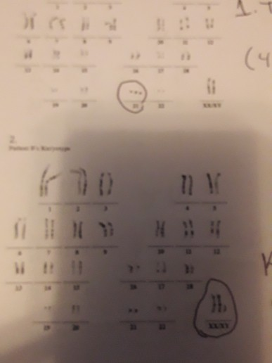 Solved MODULE 2 LAB (Karyotypes) Activity Five karyotypes | Chegg.com