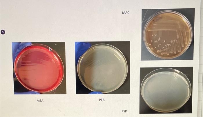Solved based on the plate results, is your bacteria | Chegg.com