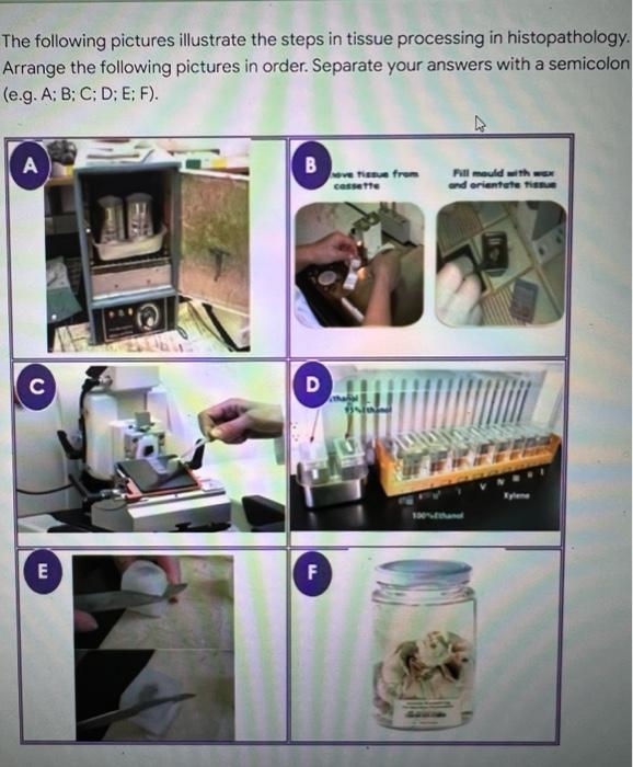 Solved The following pictures illustrate the steps in tissue | Chegg.com