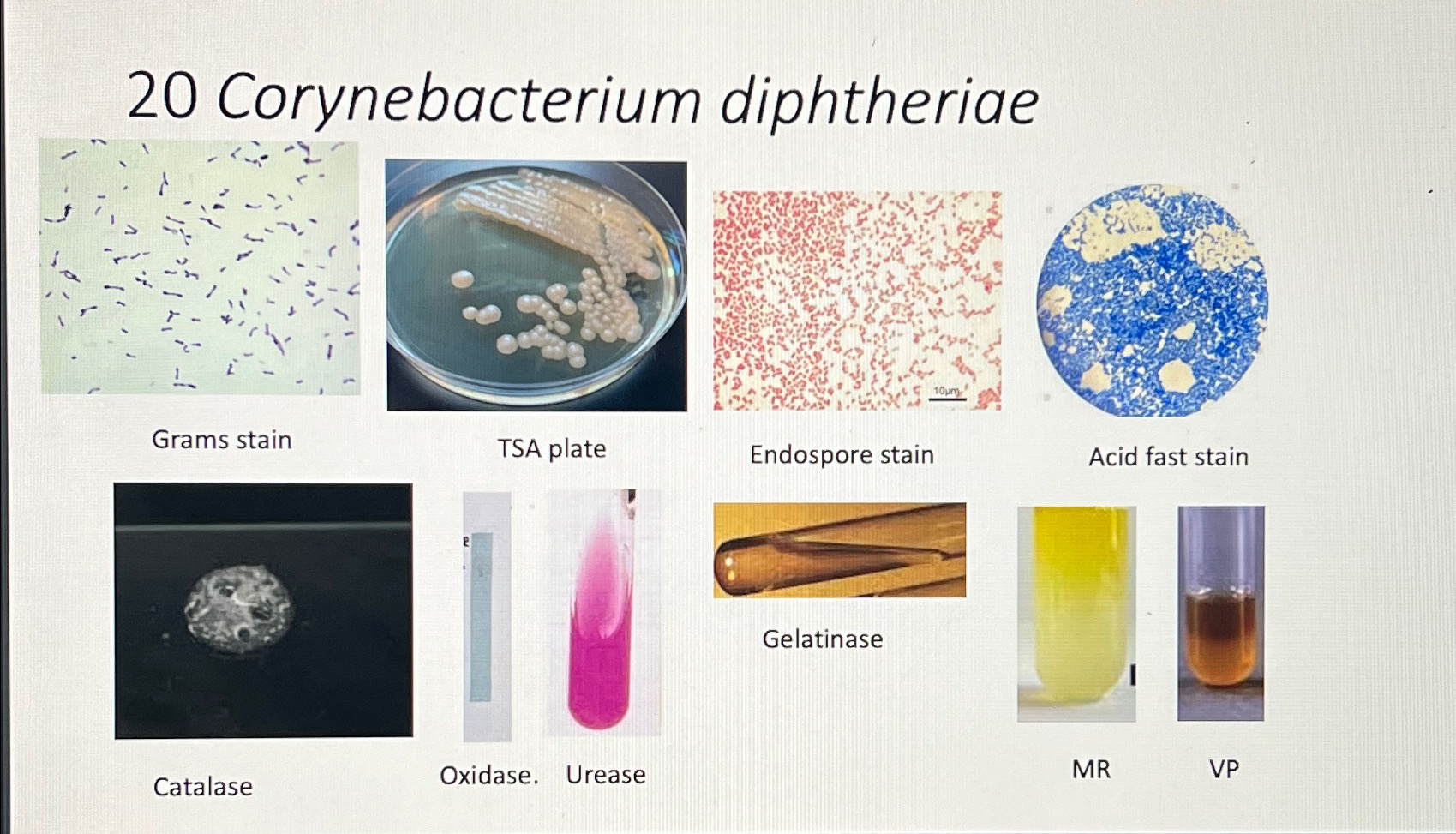 Solved 20 ﻿Corynebacterium diphtheriaeWhat is the best test | Chegg.com