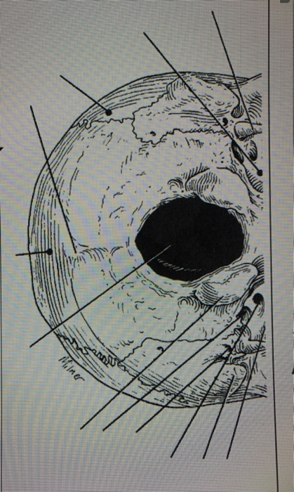 Solved Milner | Chegg.com