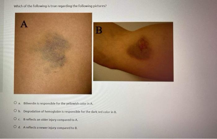 Solved Which of the following is true regarding the | Chegg.com