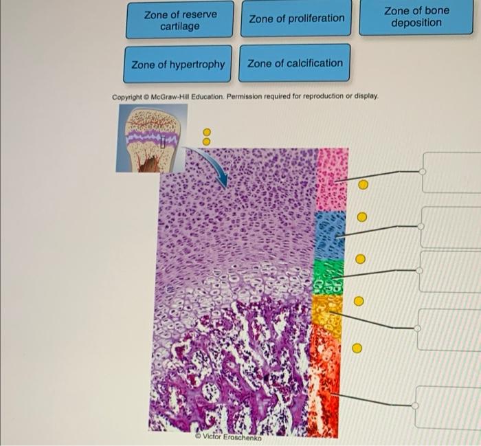 Solved Zone of reserve cartilage Zone of proliferation Zone | Chegg.com