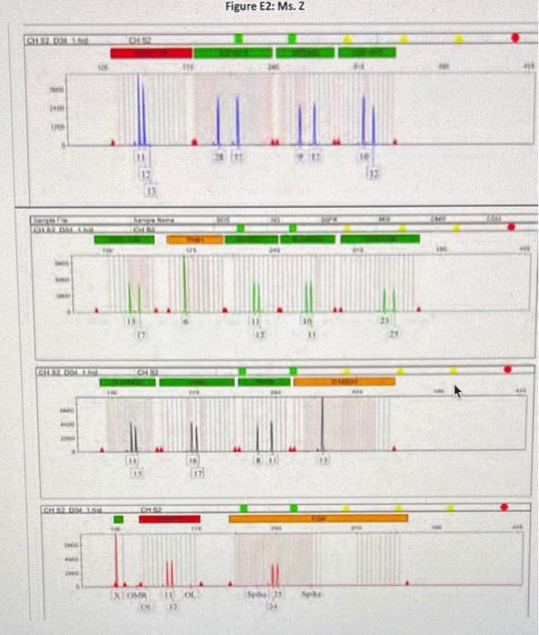 Below are four electropherograms, Figures E1-E4, | Chegg.com