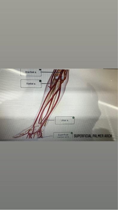 Solved label the major arteries of the forearm and hand | Chegg.com