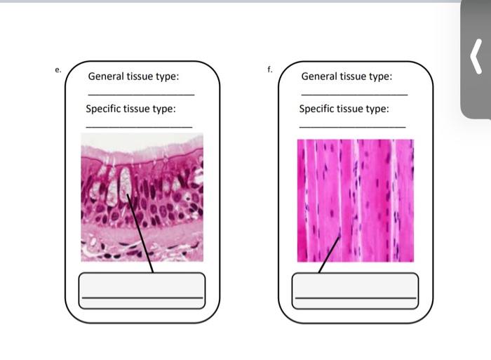 Solved General tissue type: General tissue type: Connective | Chegg.com