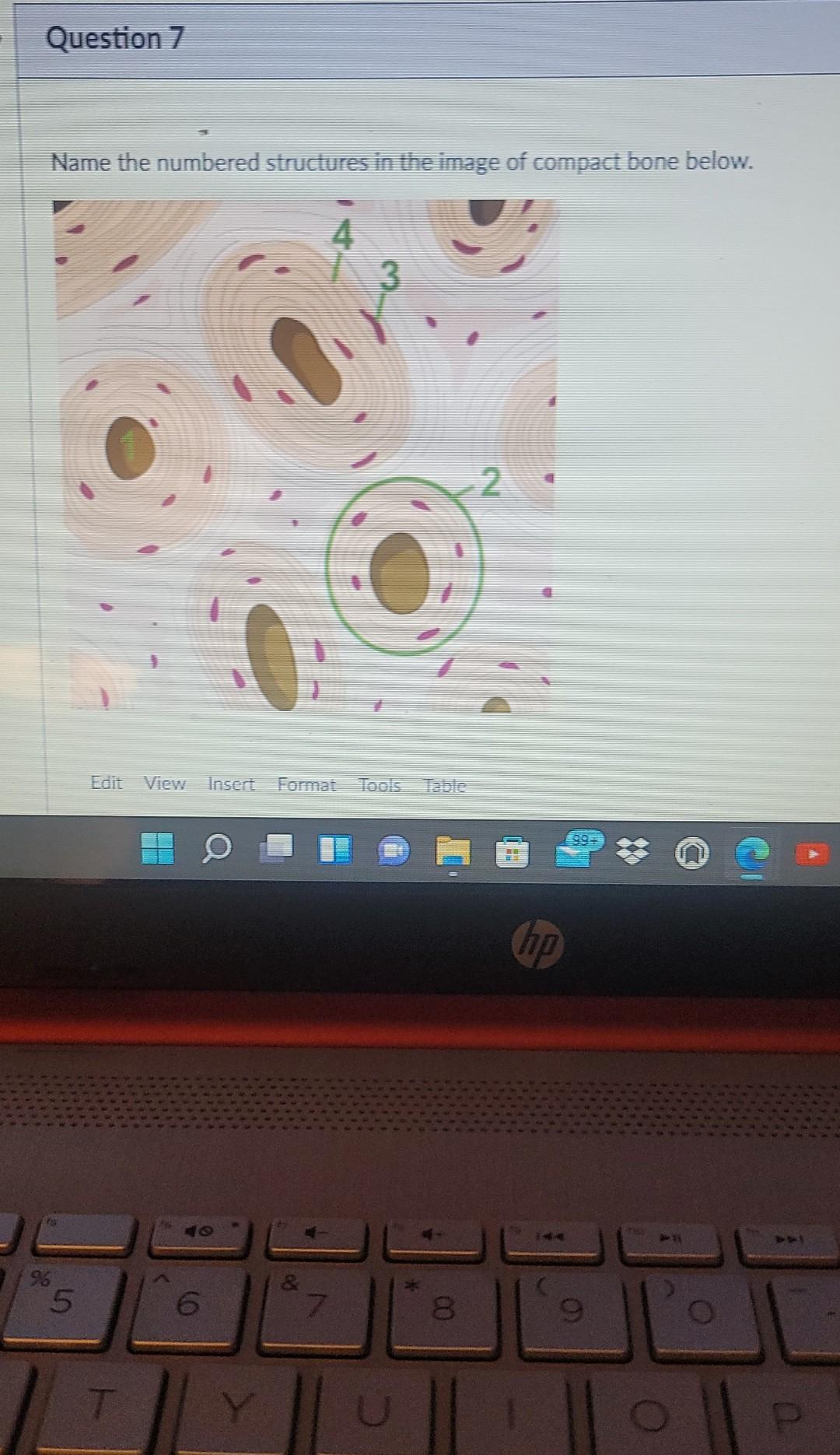 Solved Question 7 Name the numbered structures in the image | Chegg.com