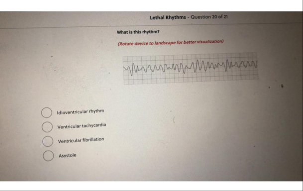 Solved Lethal Rhythms - ﻿Question 20 ﻿of 21What is this | Chegg.com