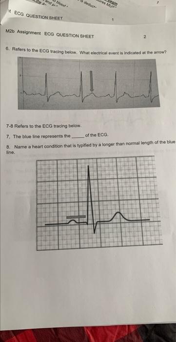 Solved M2b Assignment ECG QUESTION SHEET 2. 6. Refers to the | Chegg.com