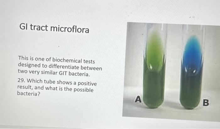 Solved GI tract microflora This is one of biochemical tests | Chegg.com