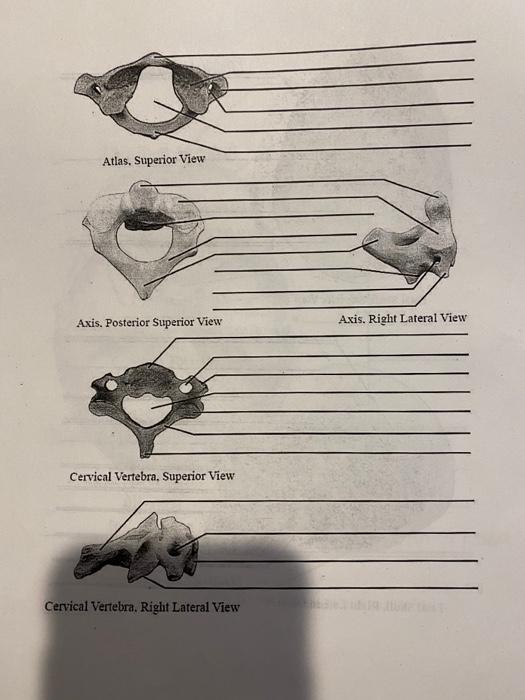 Solved Atlas, Superior View Axis. Posterior Superior View | Chegg.com