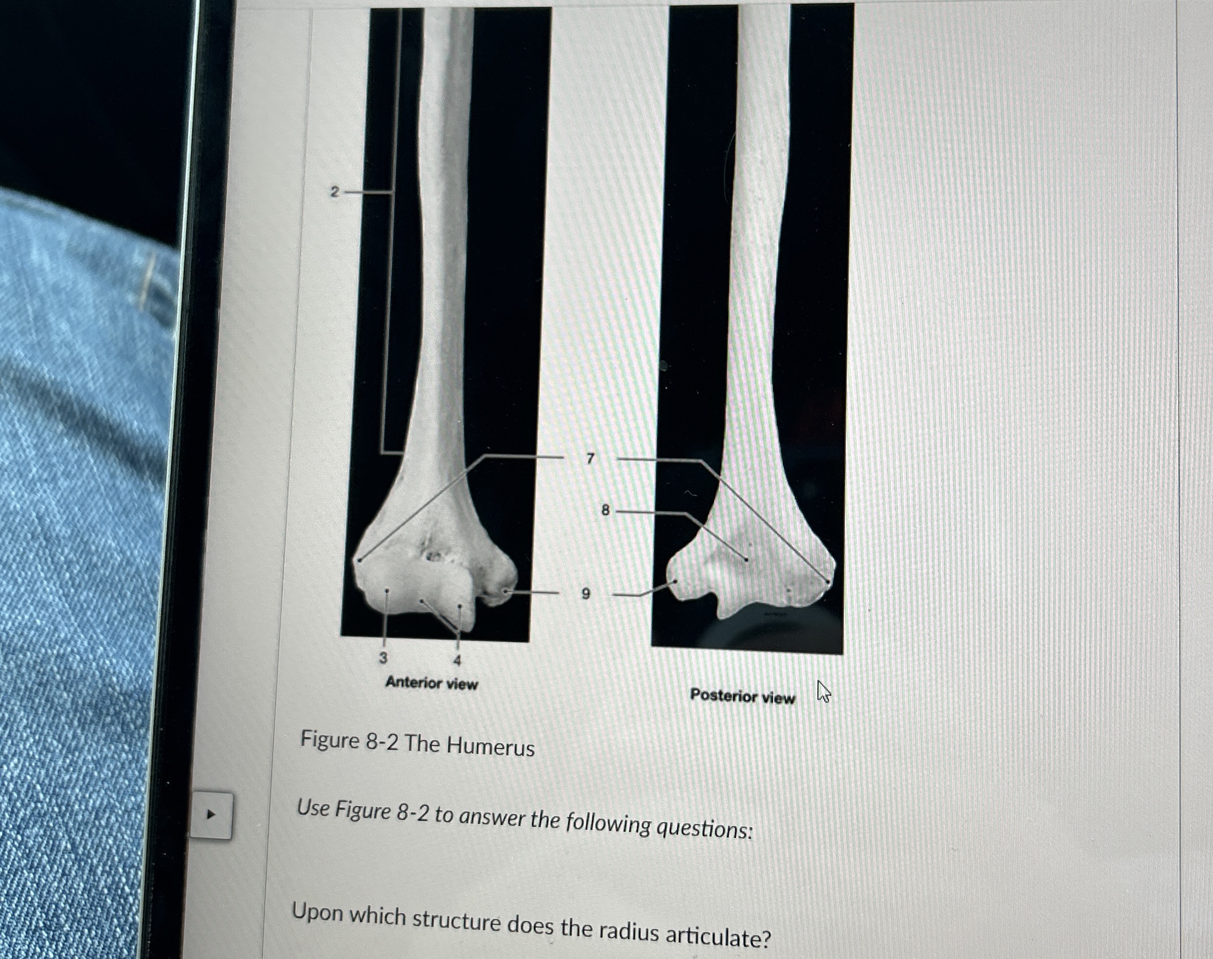 Solved Posterior viewFigure 8-2 The HumerusUse Figure 8-2 | Chegg.com Solved Posterior viewFigure 8-2 The HumerusUse Figure 8-2 | Chegg.com
