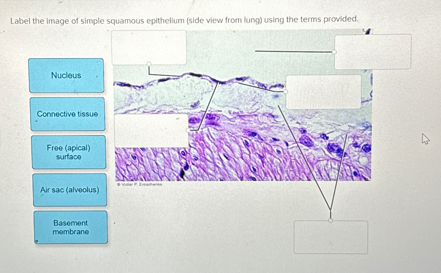 Solved Label the image of simple squamous epithelium (side | Chegg.com