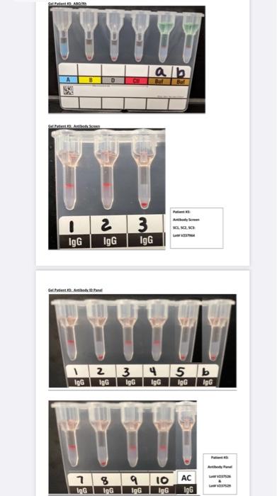 Patient ab: Giel] Date Tested: Mn Number rogecel. | Chegg.com