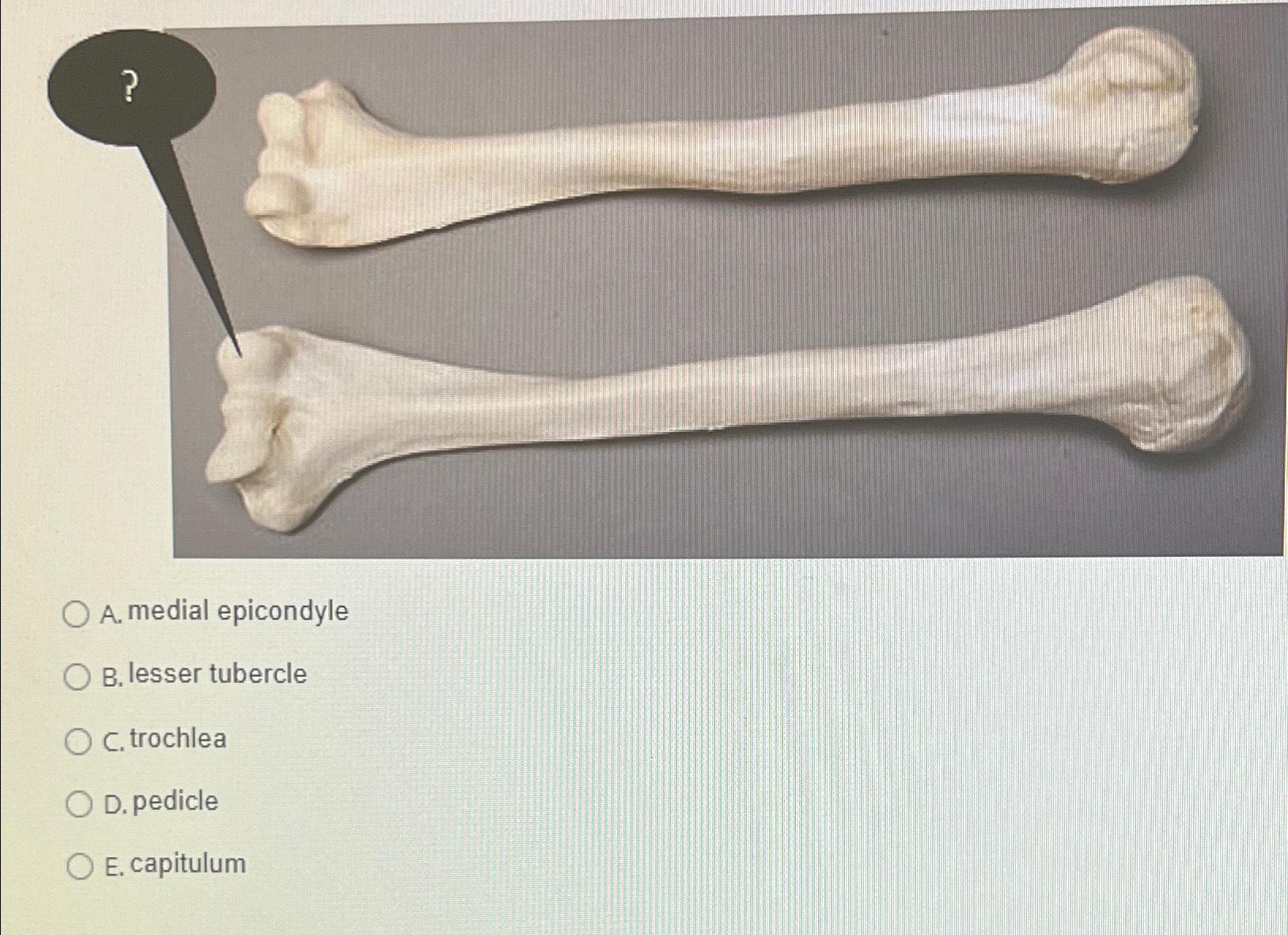 Solved ?A. ﻿medial epicondyleB. ﻿lesser tubercleC. | Chegg.com