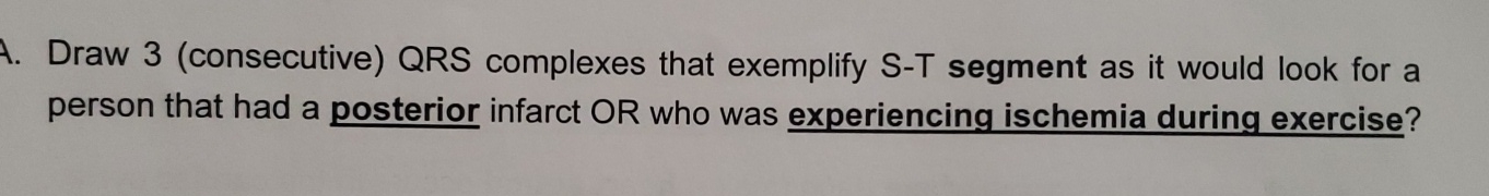 Solved Draw 3 (consecutive) ﻿QRS complexes that exemplify | Chegg.com