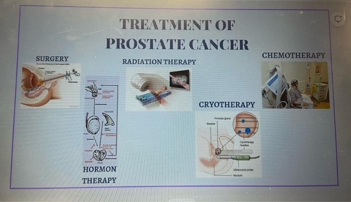 Solved Understand the meaning of prostate cancer. Describe | Chegg.com