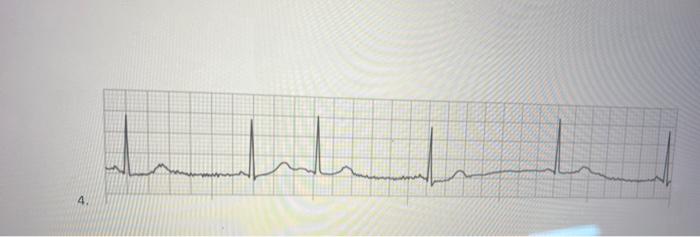 Solved identify the QRS, QT, heart rate and PR, ST, and | Chegg.com