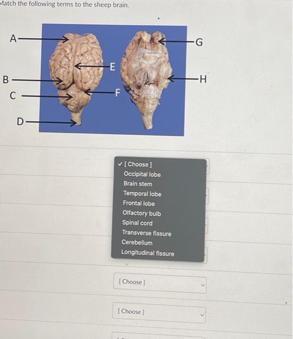 Solved Match the following structures to the brain. (letters | Chegg.com