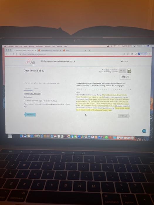 Click to highlight the findings that indicate an | Chegg.com