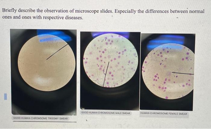 Solved Briefly describe the observation of microscope | Chegg.com