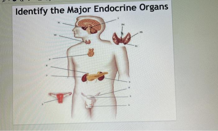 Solved Identify the Major Endocrine Organs | Chegg.com