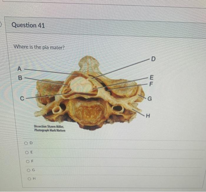Solved Question 41 Where is the pia mater? D A B F 0 m С H | Chegg.com