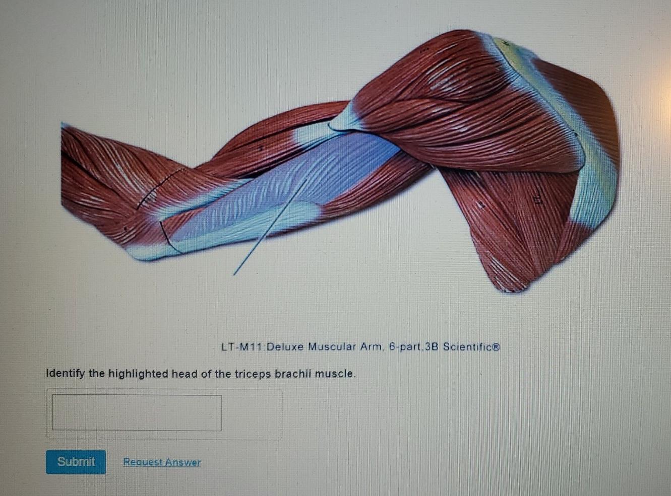 Solved Hello. Can you please identify the muscle name of the | Chegg.com
