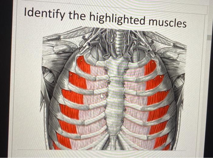 Solved Identify the highlighted muscles | Chegg.com