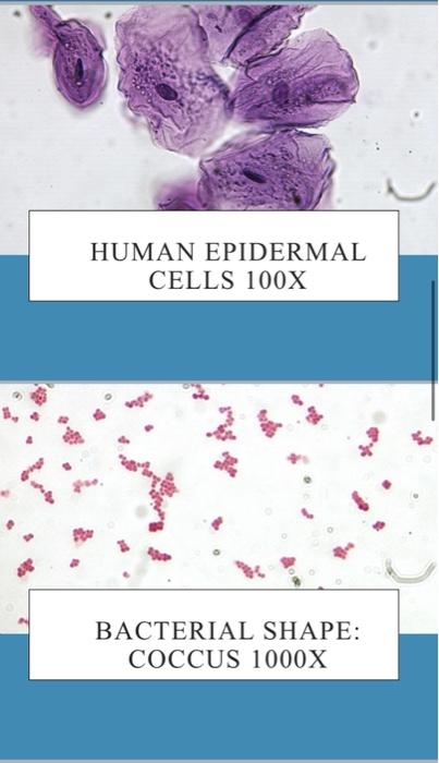 Solved ELODEA LEAF 400X ONION EPIDERMIS 100X HUMAN | Chegg.com