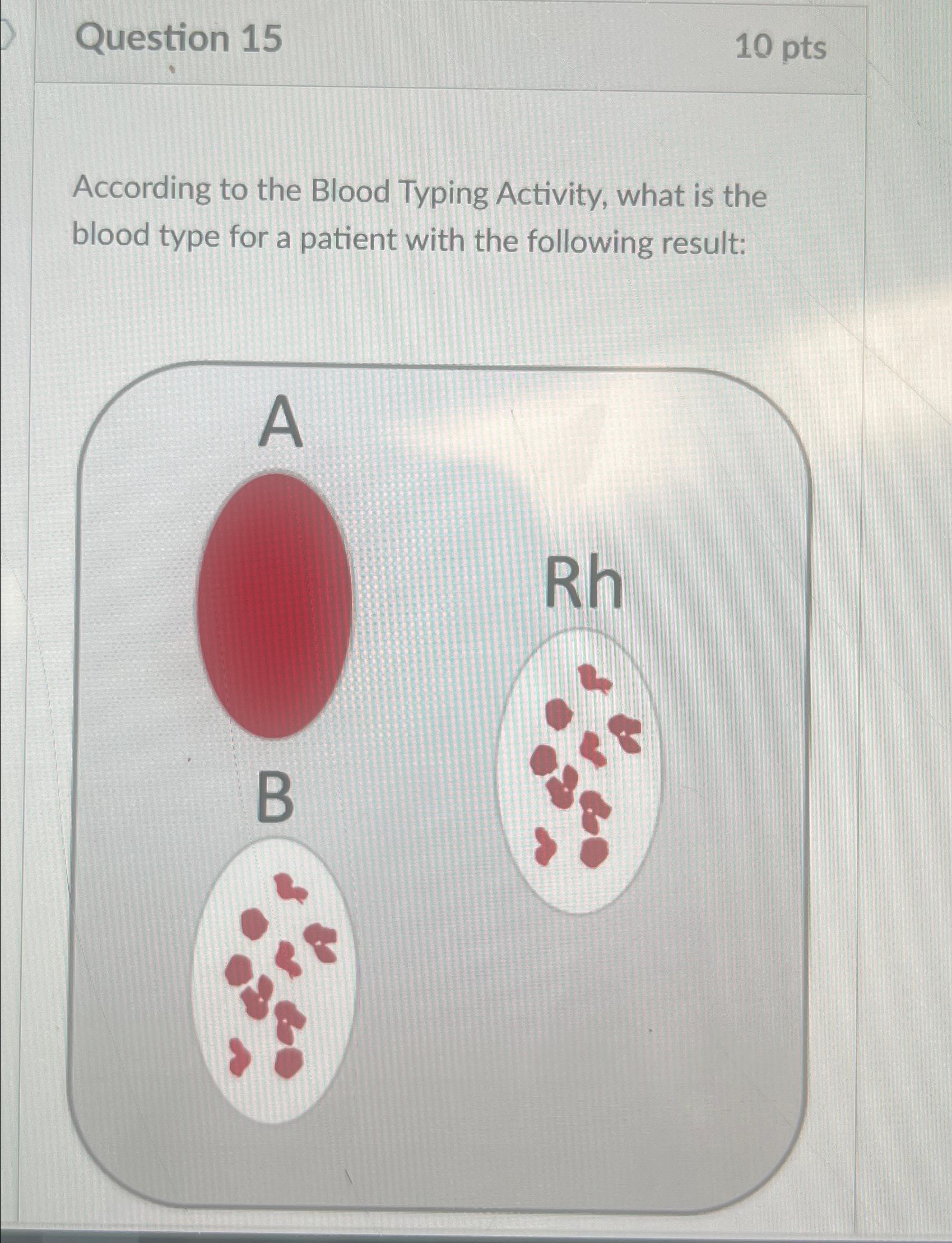 Solved Question 1510ptsAccording to the Blood Typing | Chegg.com