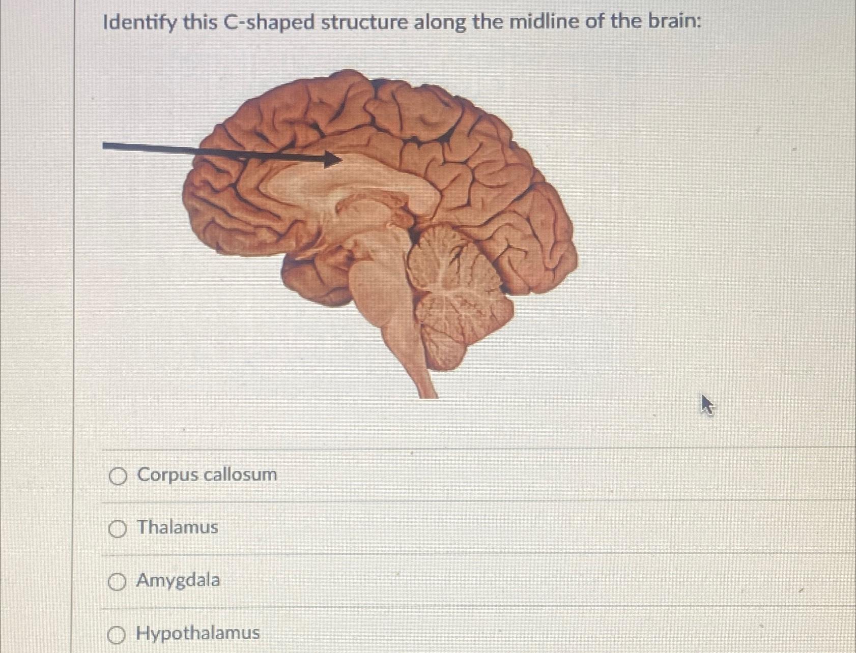 Solved Identify this C-shaped structure along the midline of | Chegg.com